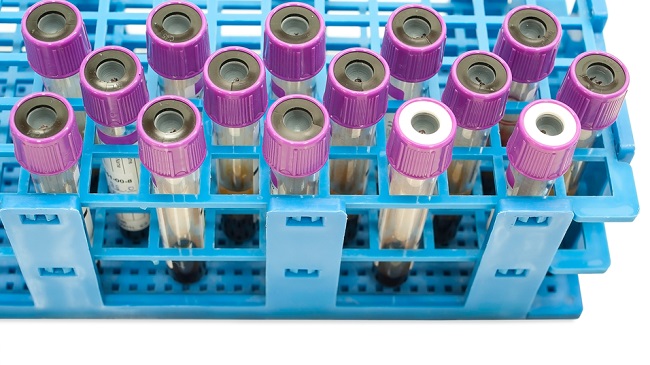 Flow Cytometry - Definition, Protocol and Test | Biology Dictionary