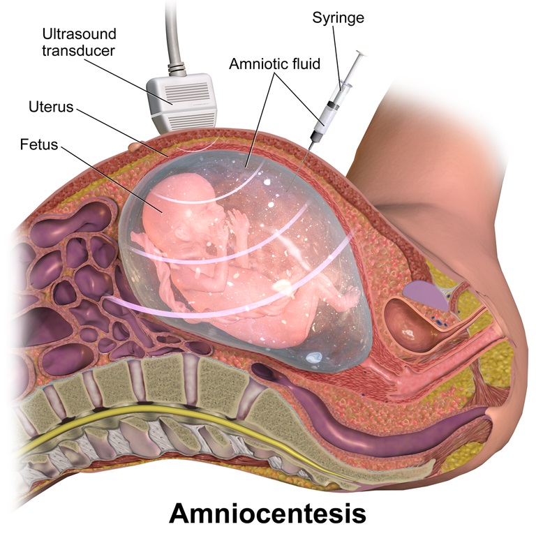 Amniotic Fluid Definition And Function Biology Dictionary Amniotic Fluid Definition And Function Biology Dictionary