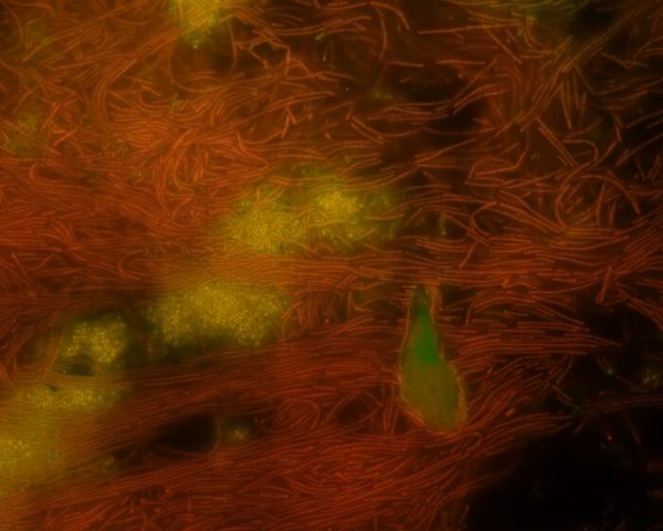 Biofilm - Definition, Function and Structure | Biology Dictionary