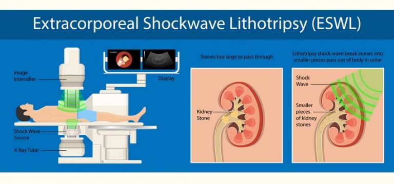 Urethra - Definition, Function and Structure | Biology Dictionary