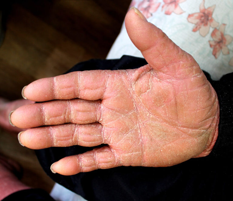 Stop Codon - The Definitive Guide | Biology Dictionary