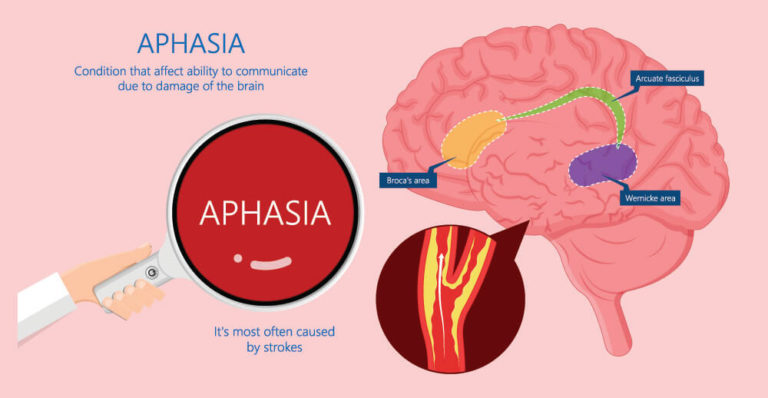Temporal Lobe - The Definitive Guide | Biology Dictionary Temporal Lobe - The Definitive Guide | Biology Dictionary