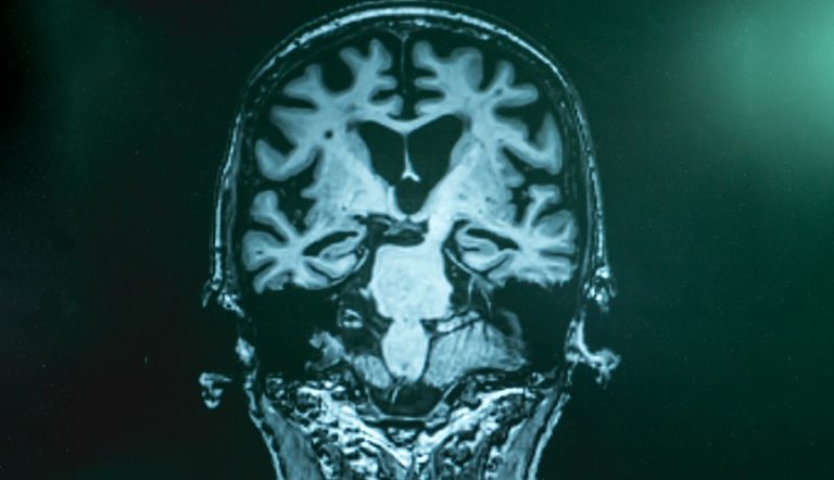 IGF-1 - The Definitive Guide | Biology Dictionary