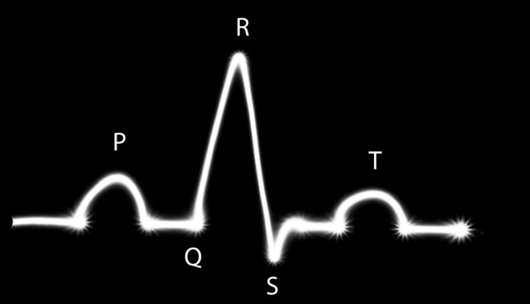 P Wave - The Definitive Guide