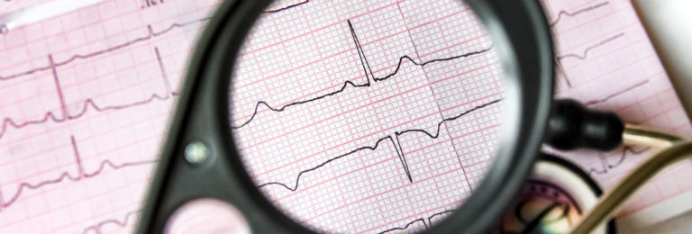 P Wave - The Definitive Guide