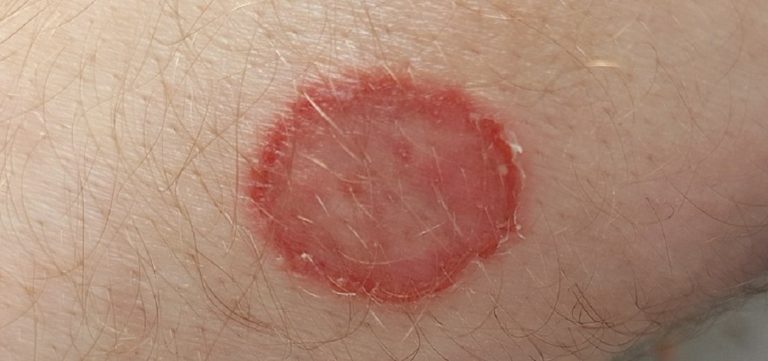 Bacillus Subtilis - Le guide définitif | Market tay