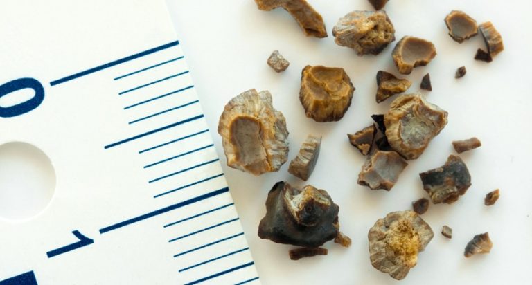 The Kidney - The Definitive Guide