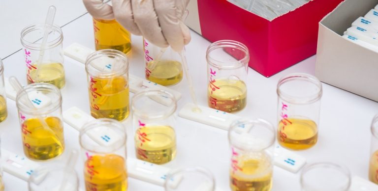 The Kidney - The Definitive Guide | Biology Dictionary