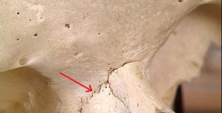 Maxilla Bone - The Definitive Guide