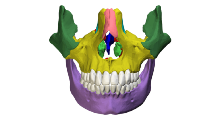 Facial Bones - The Definitive Guide | Biology Dictionary