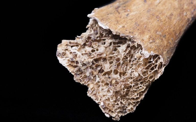 Connective Tissue - The Definitive Guide | Biology Dictionary