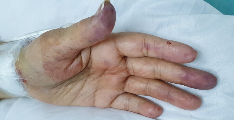 Oxygen Saturation - The Definitive Guide | Biology Dictionary