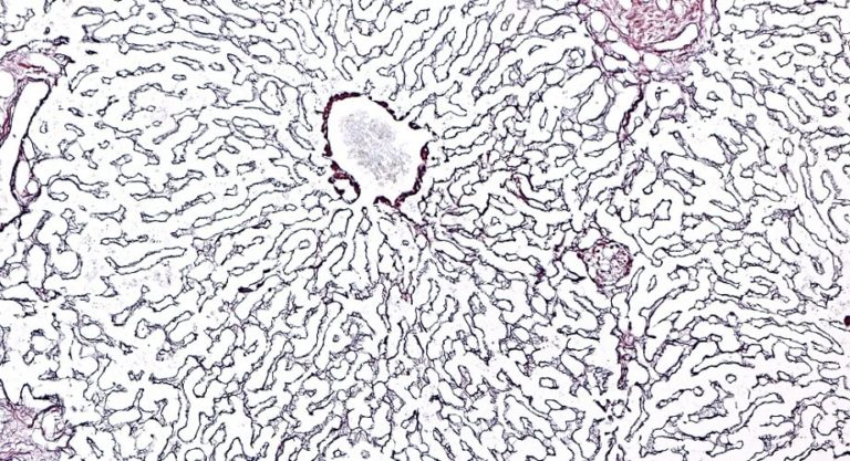 Connective Tissue - The Definitive Guide | Biology Dictionary