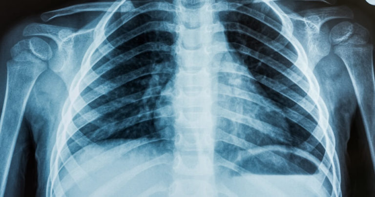 Valsalva Maneuver - The Definitive Guide