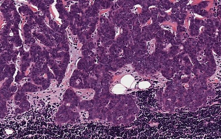 Basal Cell - The Definitive Guide | Biology Dictionary