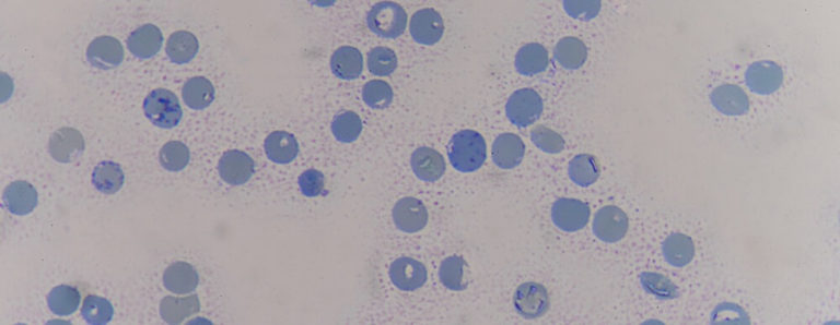 Red Blood Cell - The Definitive Guide