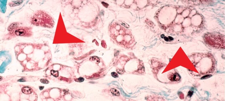 Adipocyte - The Definitive Guide | Biology Dictionary